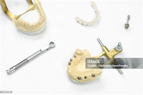 흰색 배경에 치과 임플란트가있는 흰색 세라믹 치아 토크 렌치와 치과 드라이버 임플란트에 대한 치과 이식 및 정형 외과 치과의 개념 치과 대치가 뒤틀리다 건강관리와 의술에