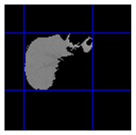 Results Of Image Preprocessing By K Means Algorithm A Original