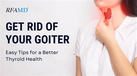 How To Get Rid Of A Goiter Rfamd