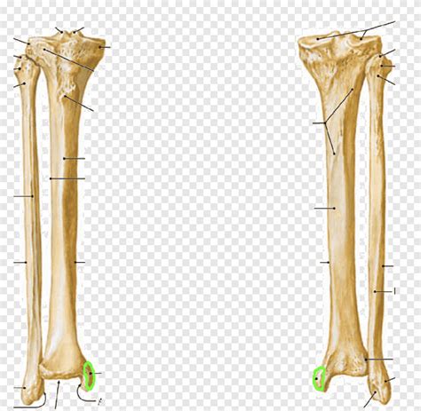 Lateral Condyle Tibia