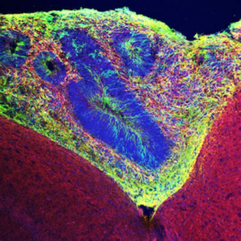 Grafted Brain Organoids Provide Insight Into Neurological Disorders Salk Institute For