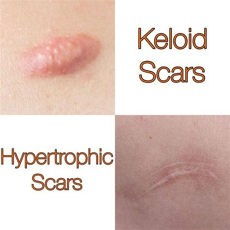 Pin On Dermatology Tips