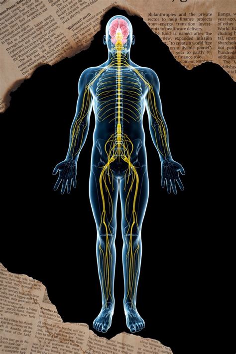 Tarlov Cyst Disease And Nerve Damage New Research Reveals Hidden Burden