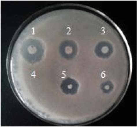 Bacillus Subtilis Mutants Challenged With Flat Grey Mould Download Scientific Diagram