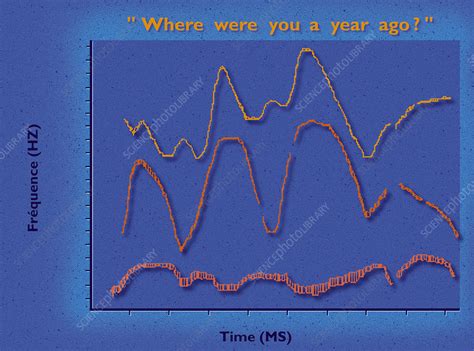 Speech Synthesizer Stock Image C004 4345 Science Photo Library