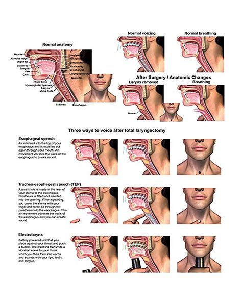 Buy Ynb Electronic Larynx Anatomy Human Larynx Scientific Wall Charts
