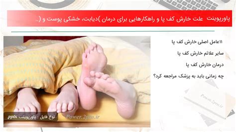 دانلود پاورپوینت چرایی خارش کف پا و راهکارهایی به منظور درمان دیابت