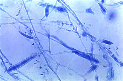 Ringworm Fungus Light Micrograph Stock Image C057 3951 Science Photo Library