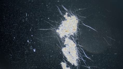 Cyanobacteria Algae Movement In Light Under Microscope Dark Field View