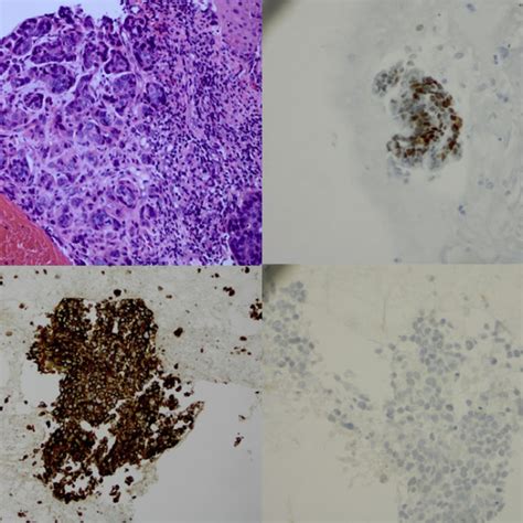 Ultrasound Of The Thyroid Gland Shows A Diffusely Enlarged And Download Scientific Diagram