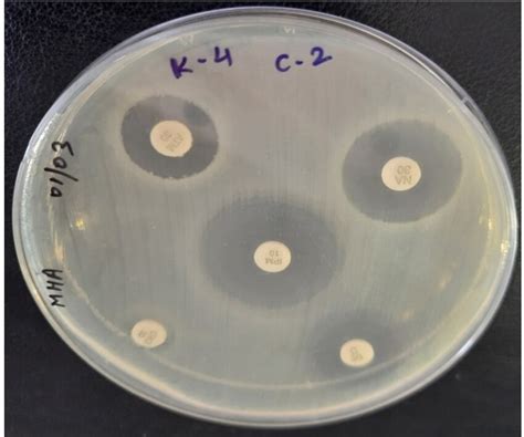 Antimicrobial Sensitivity Pattern Of Esbl Isolates Against Aztreonam Download Scientific