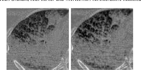 Figure 2 From An Interactive Multiscale Framework For Enhancement And Visualization Of 2d And 3d