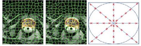 A C Original Image With Superimposed Supervoxels Green Manual Download Scientific