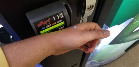 Rfid And Nfc Human Chip Implants Biohacking