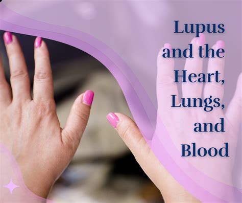 Low 💜 Lupus And Heart Health What You Need To Know 💜 Did You Know That Lupus Can Increase The