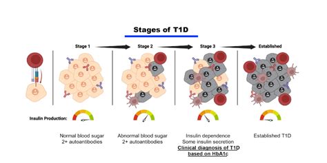 Type 1 Diabetes Biology Breakthrough T1d