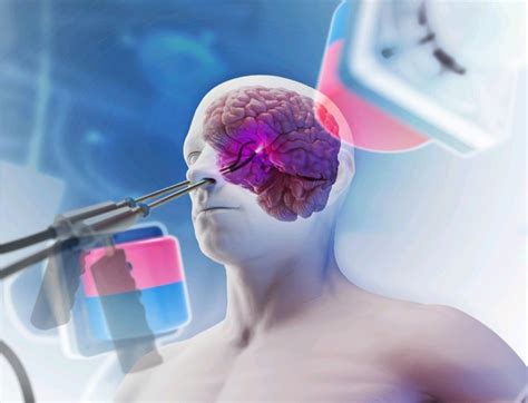 Tiny Tentacle Robots Show Promise In Detecting And Treating Lung Cancer