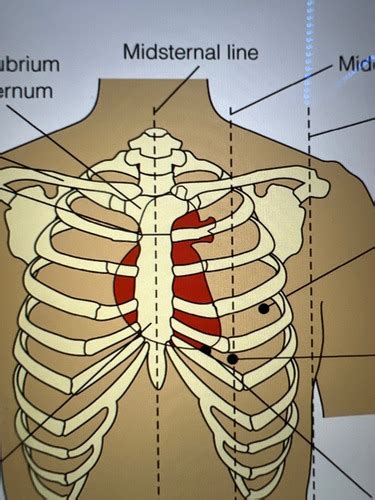 Quiz2 Flashcards Quizlet