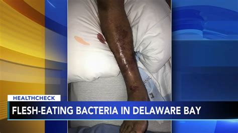 Louisiana Man Recovering In Icu From Near Death Experience After