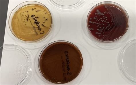 Gram Negative Lab Practical 2024 Flashcards Quizlet