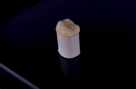 Plamen Vasilev On Linkedin Single Full Contoured Zirconia Can Be A Beauty Designed By Owen