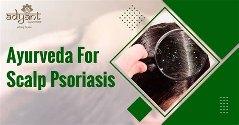 Scalp Psoriasis Ayurvedic Treatment Cure Ekakushtha Naturally