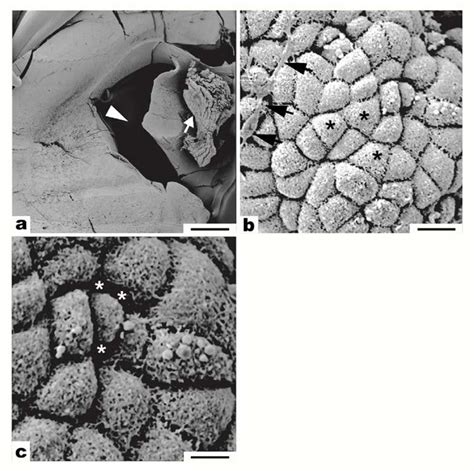 Scanning Electron Micrograph Showing A The Choroid Plexus White Download Scientific Diagram
