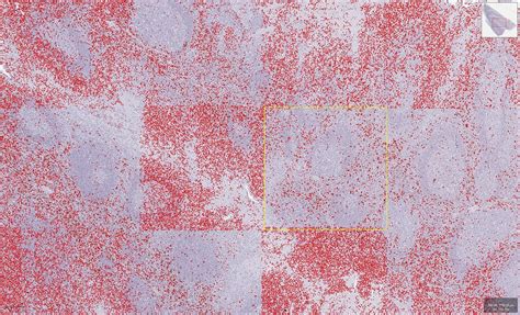 Cellpose Extension In Qupath Cannot Get Deconvolution And Normalization Working Together