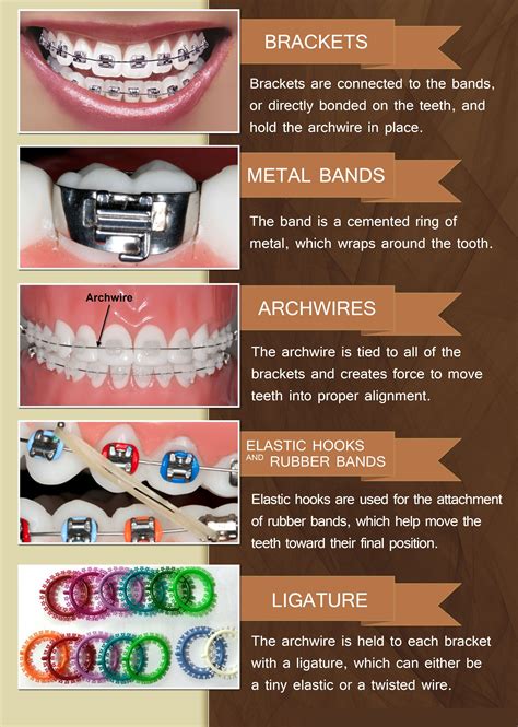 What Is Ortho Braces At Marc Hutchinson Blog