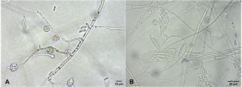 Morphological Features Of Fusarium Sp Isolates From Diseased Korean Download Scientific