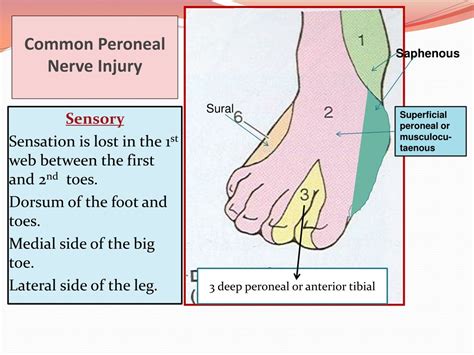 Ppt Sciatic Nerve Anatomy Injuries And Effects Powerpoint