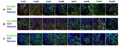 Sex Specific Proximal Tubular Cell Differentiation Pathways Identified By Single Nucleus Rna