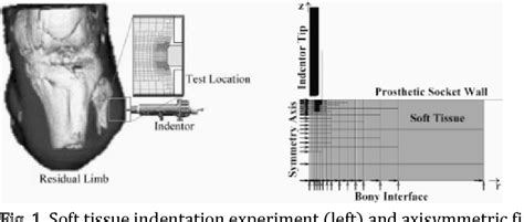 Figure 1 From Nonlinear Elastic Material Property Estimation Of Lower Extremity Residual Limb