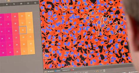 Automated Solutions For High Content Imaging Applications