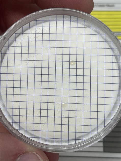 How Would You Count This Plate R Microbiology