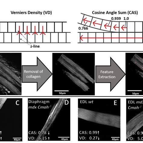 Extensive Fibrosis In Hande Muscle Cross Sections Of Edl And Diaphragm Download Scientific