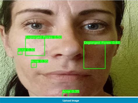 Custom Object Detection Solutions Using Yolo And Computer Vision Upwork