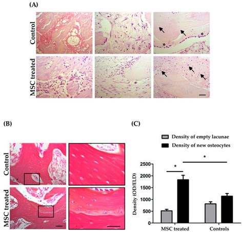 Autologous Marrow Mesenchymal Stem Cell Driving Bone Regeneration In A Rabbit Model Of Femoral