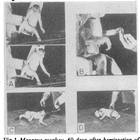 Figure 1 From The Midbrain And Motor Integration Semantic Scholar