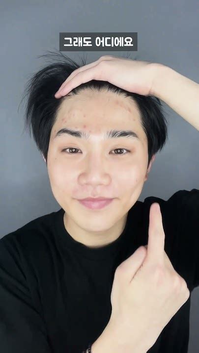 여드름 뚝딱 해결하는 법 Youtube