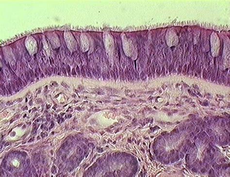 Slide 106 Nasal Epithelium