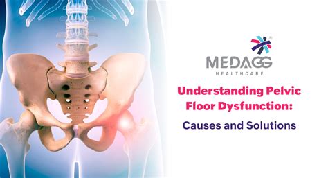 What Is Pelvic Floor Dysfunction Causes And Solutions Medagg