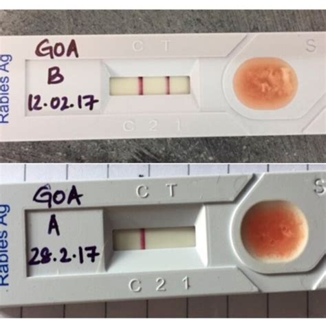 Flow Immunochromatographic Assay Lfa Showing A Positive Result Top Download Scientific