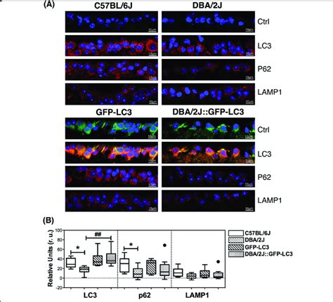 Evaluation Of Autophagy In The Gcl Of C57bl 6j And Dba 2j Mice A Download Scientific Diagram