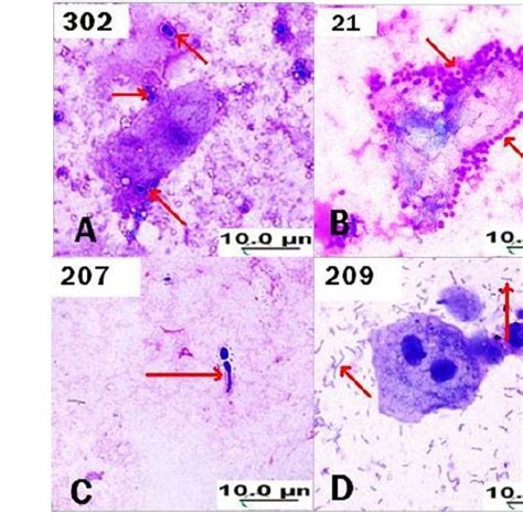 Detected Color Of Candida Species On Chrom Agar Candida” A C