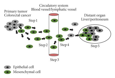 Invasion Metastasis Cascade Local Invasion Of Colorectal Cancer Cells Download Scientific