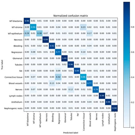 Confusion Matrix For The Ensemble Of Densenet And U Net This Shows Download Scientific Diagram