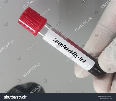 Osmolality Test Method At Christine Voss Blog