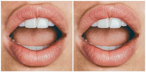 What Is The G Spot Injection And How Does It Make Sex Hot Yourtango