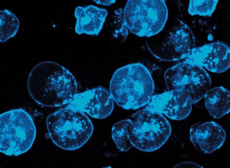 A Field Guide To Mapping The Tumor Microenvironment With Spatial Transcriptomics In Complex